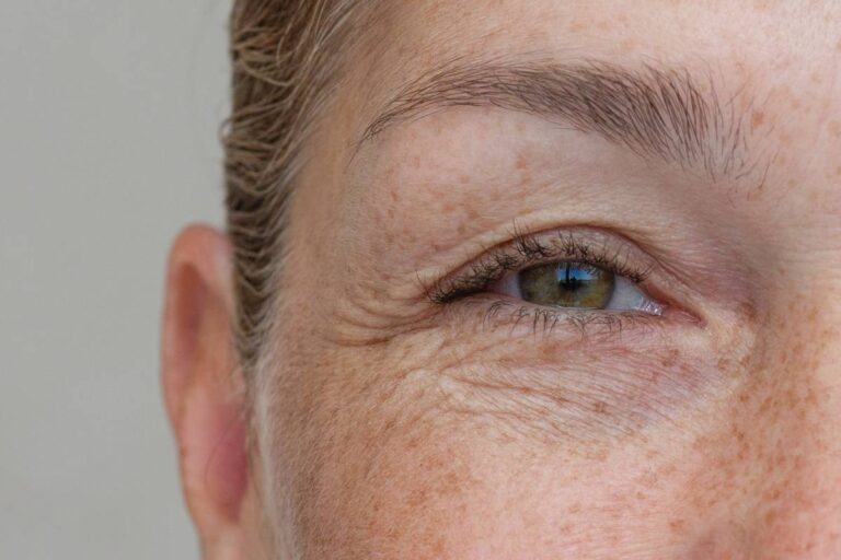 Which Muscle Controls the Eyelids? - Oasis Eye Face and Skin